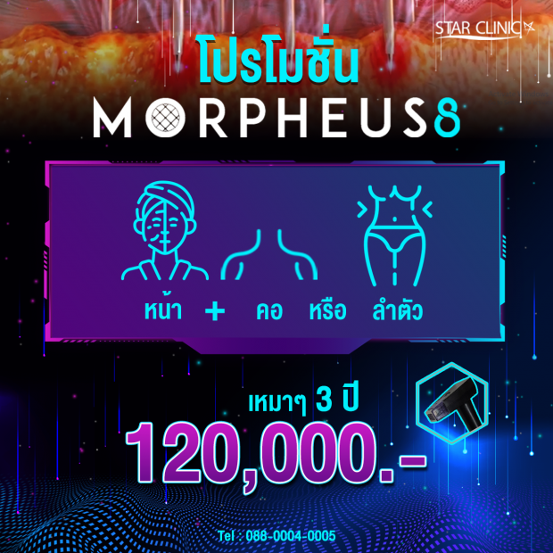 Morpheus8 เทคโนโลยียกกระชับStar Clinic Star Clinic