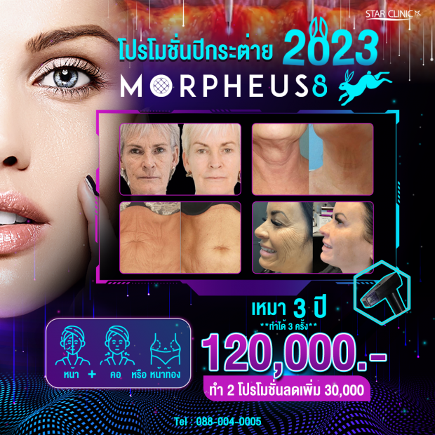 Morpheus8 เทคโนโลยียกกระชับStar Clinic Star Clinic